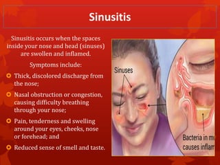 Nose and Sinus Disorders | PPTX