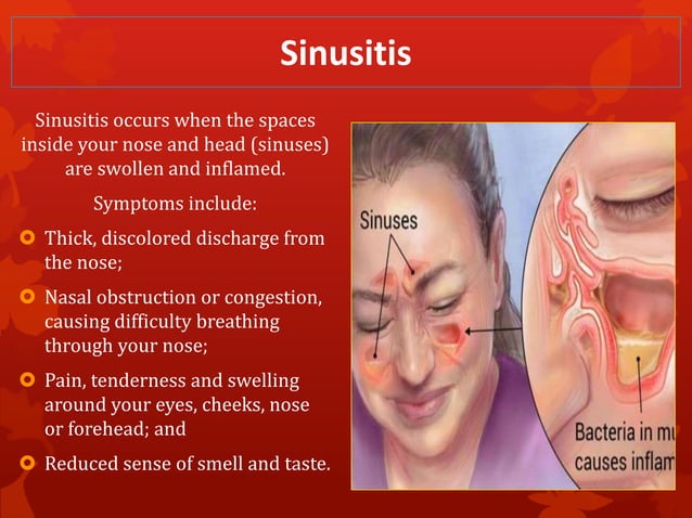 Nose and Sinus Disorders | PPTX | Allergies | Diseases and Conditions