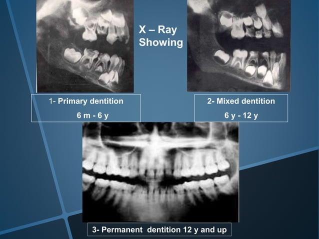over view of dentition | PPT