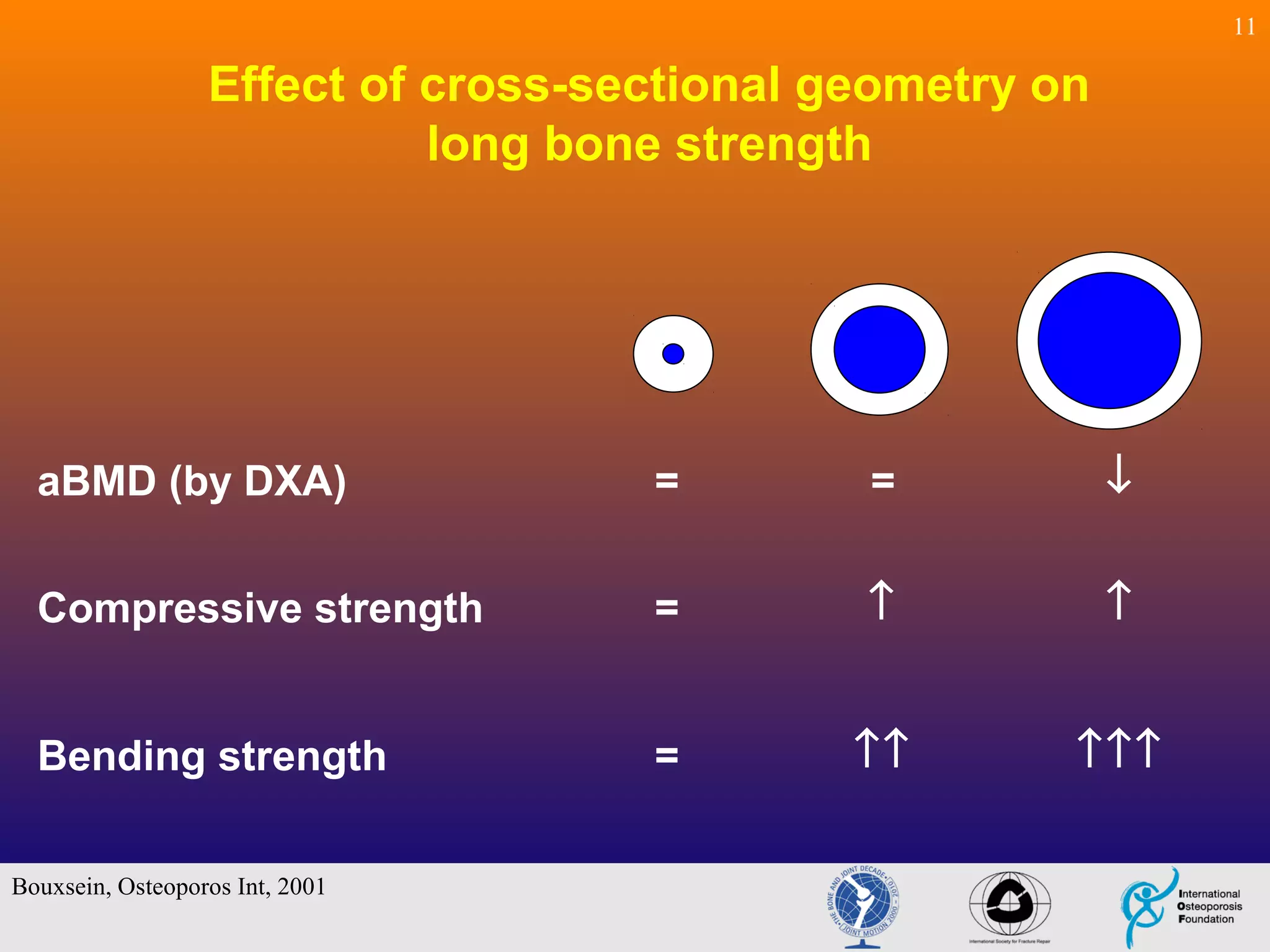 Fragility Fractures - Pathogenesis-Biomechanical View | PPT