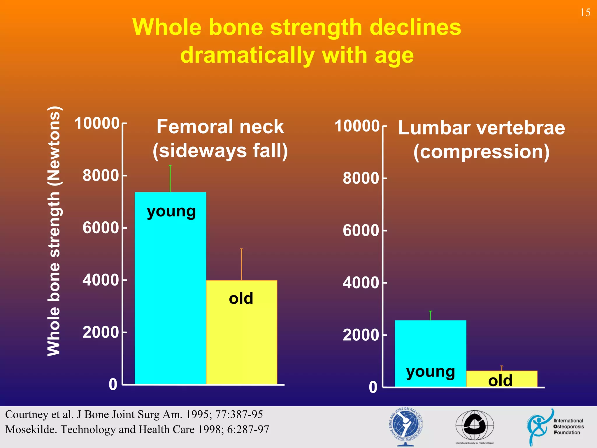 Fragility Fractures - Pathogenesis-Biomechanical View | PPT