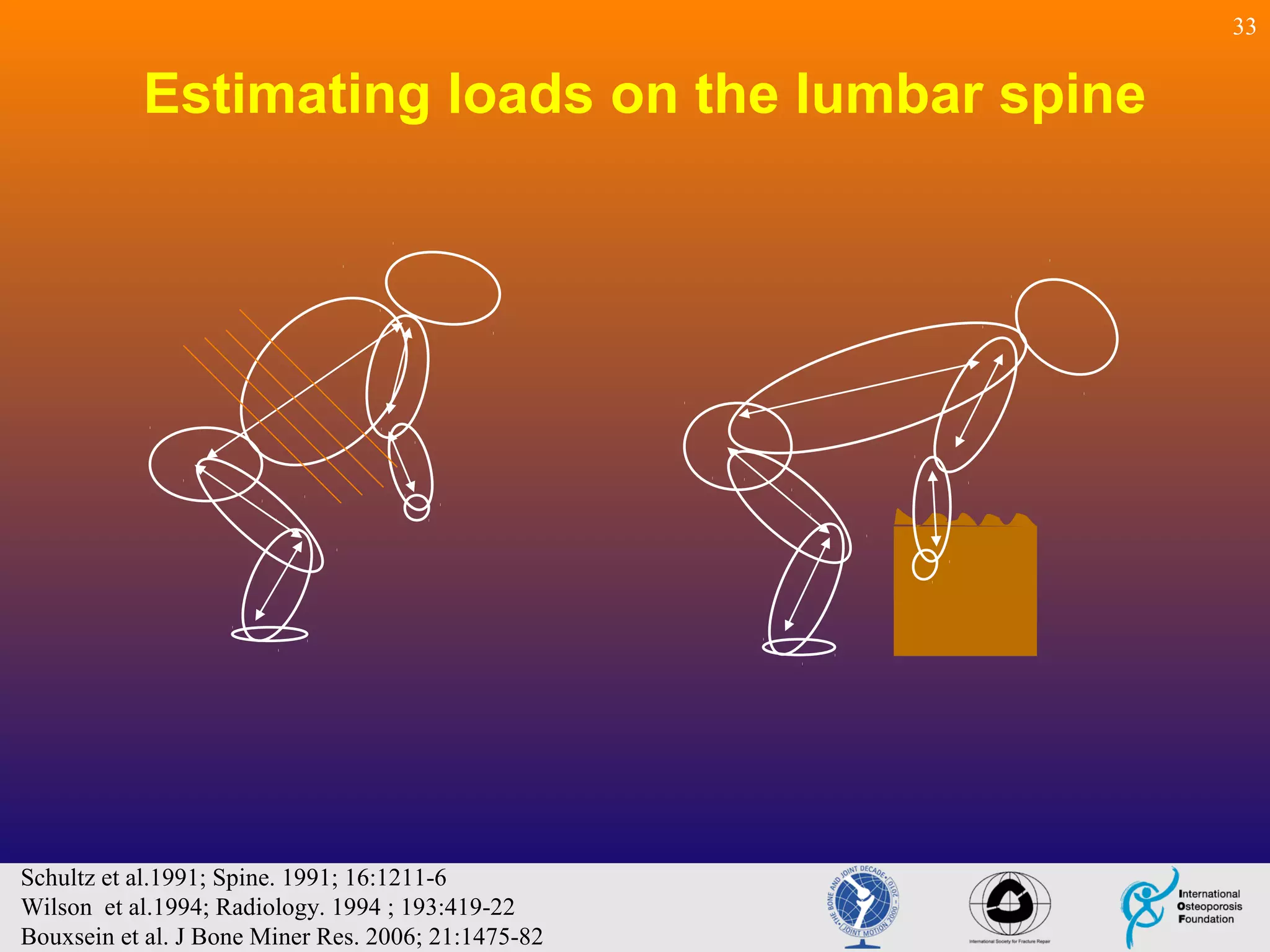 Fragility Fractures - Pathogenesis-Biomechanical View | PPT