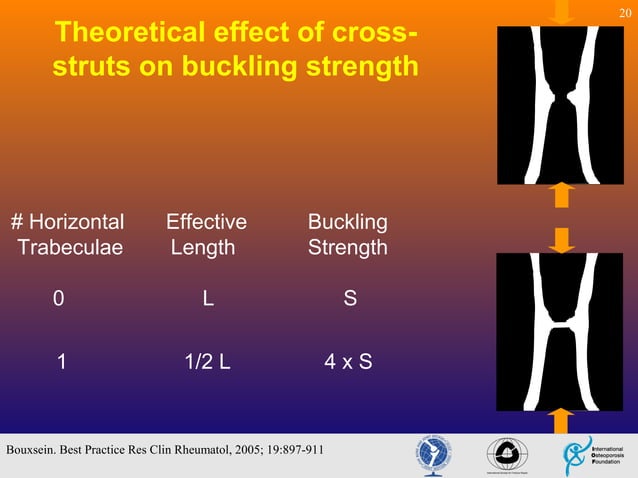Fragility Fractures - Pathogenesis-Biomechanical View | PPT