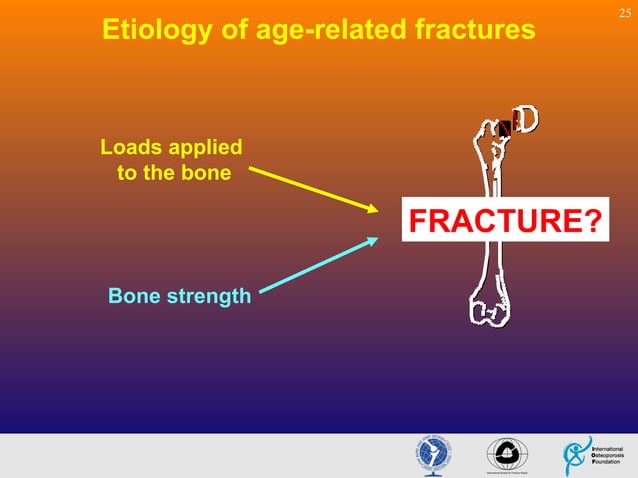Fragility Fractures - Pathogenesis-Biomechanical View | PPT