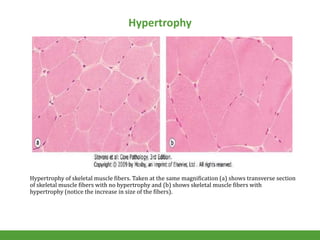 2- Pathology CELL INJURY L1 Medical Sept 2020.ppt