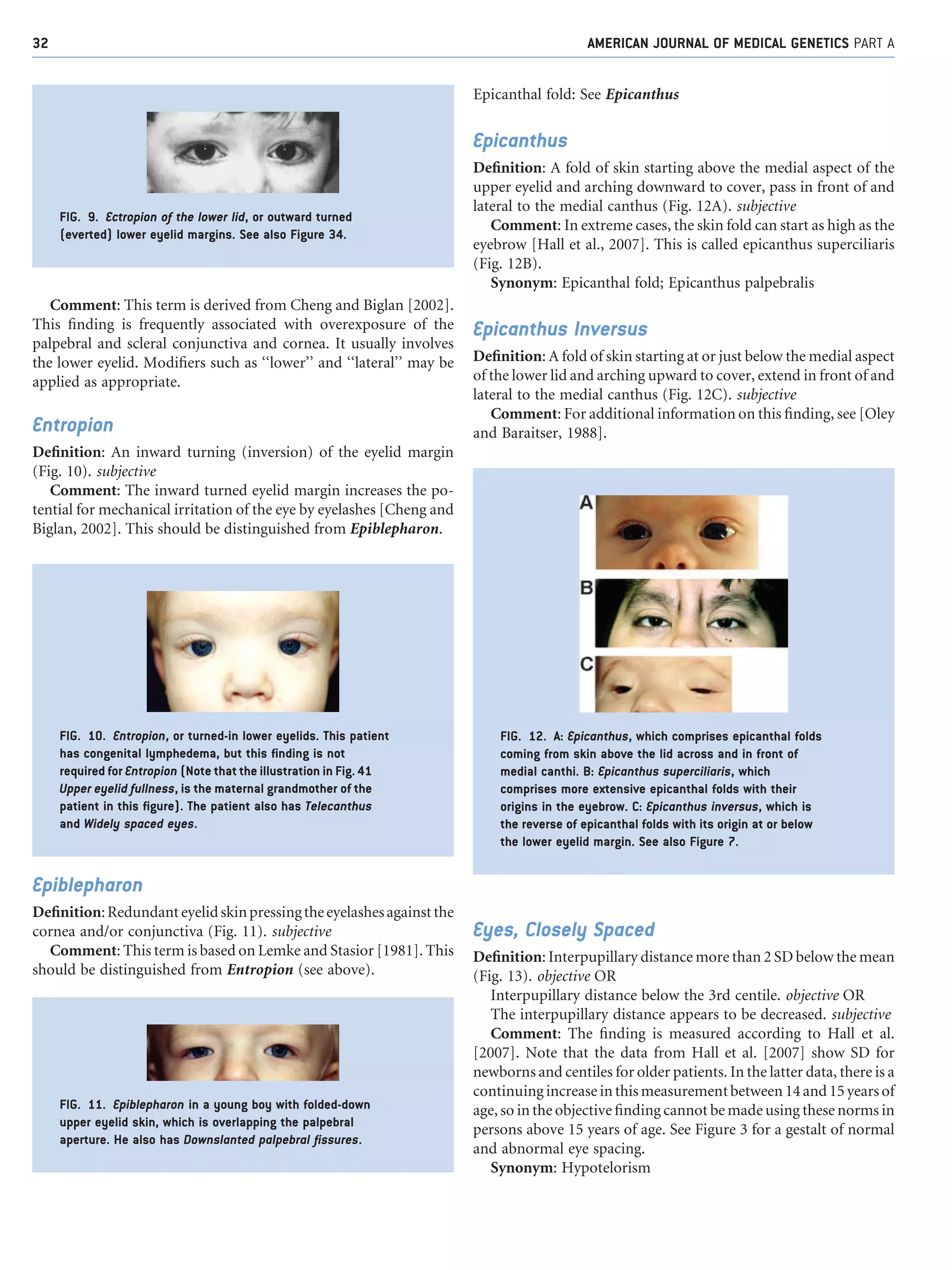 2 periorbital | PDF