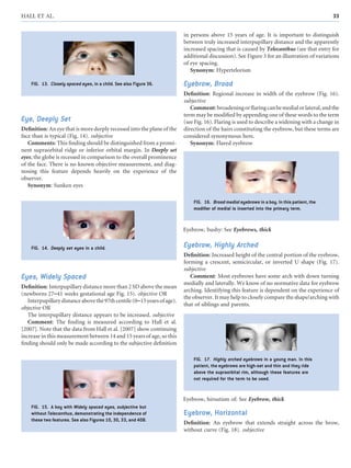 2 periorbital | PDF