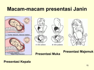 2 persalinan-normal | PPT