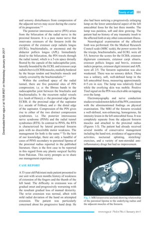 2 pin syndrome | PDF