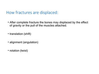 2- Principles_of_fractures for physiotherapy .ppt