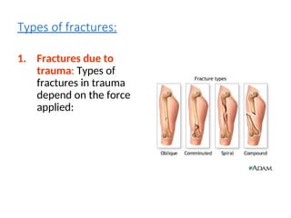 2- Principles_of_fractures for physiotherapy .ppt