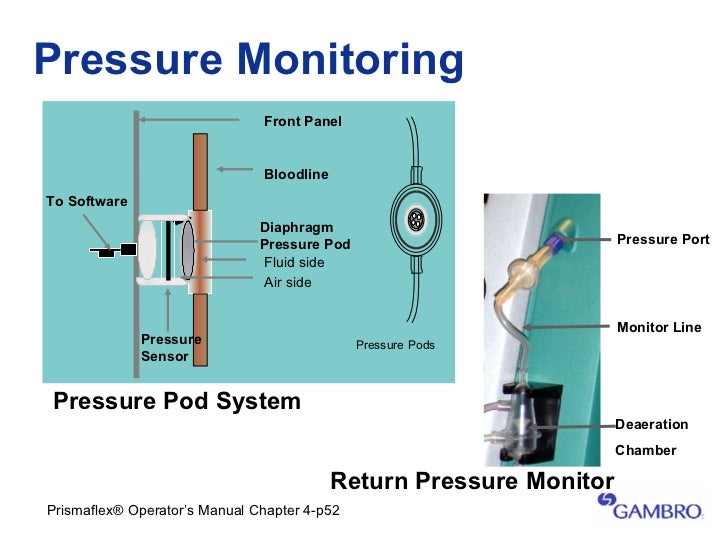 [CRRT study package-(5)] 알람을 진짜로 이해하고 문제 해결하기. : 네이버 블로그