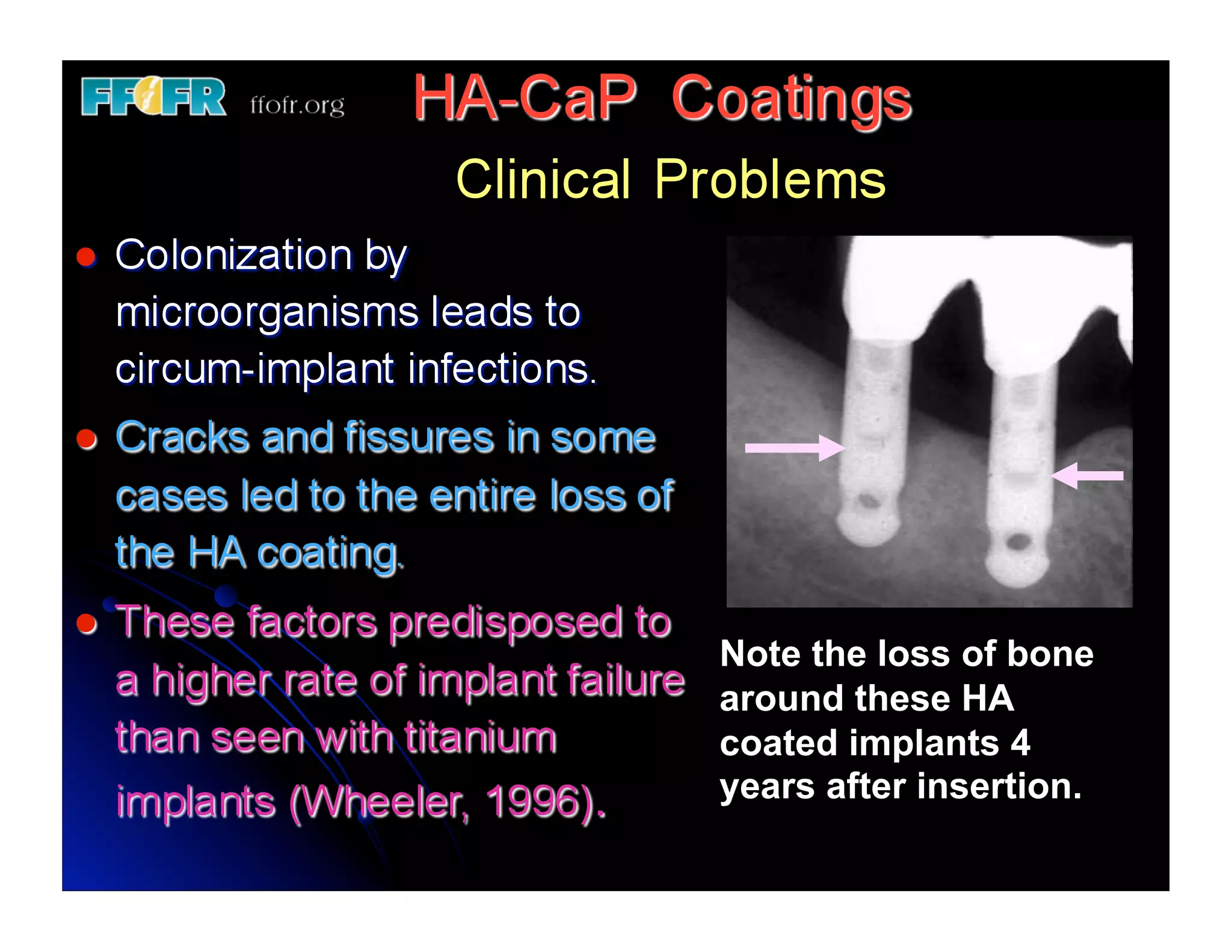 2.recent advances in implant surface science | PDF