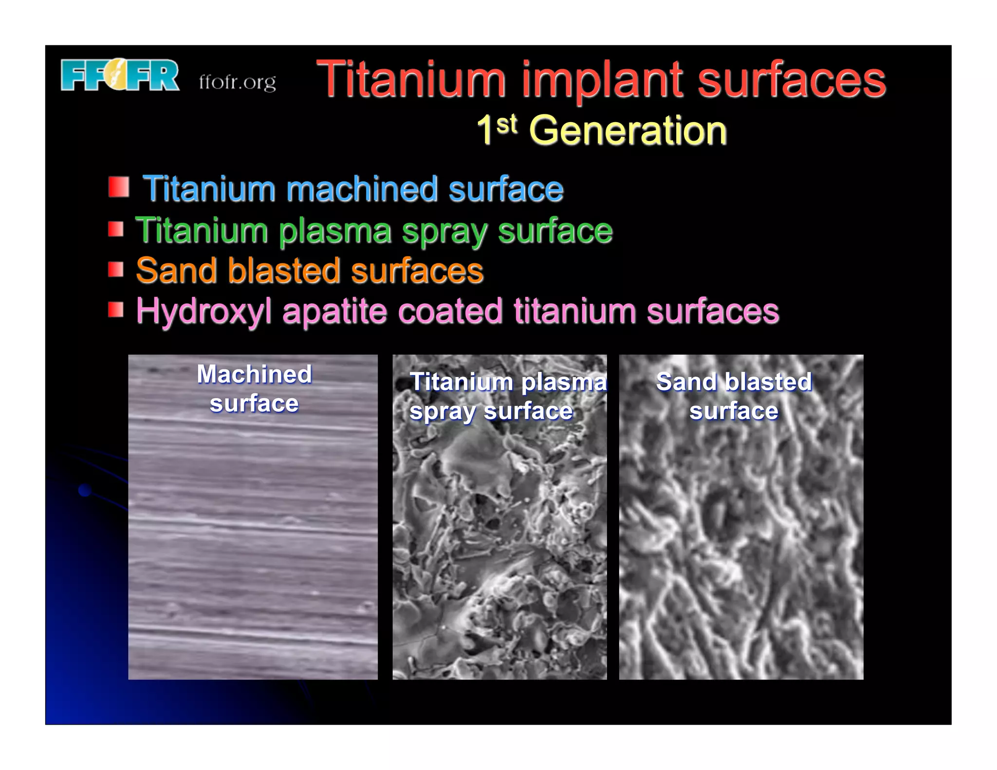 Recent Advances in Implant Surface Science | PDF
