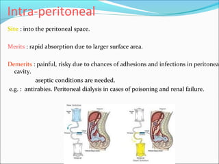 Routes of drug administartionvpp | PPT