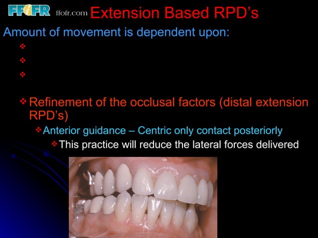 2.rpd biomechanics | PPT | Dental Health | Diseases and Conditions