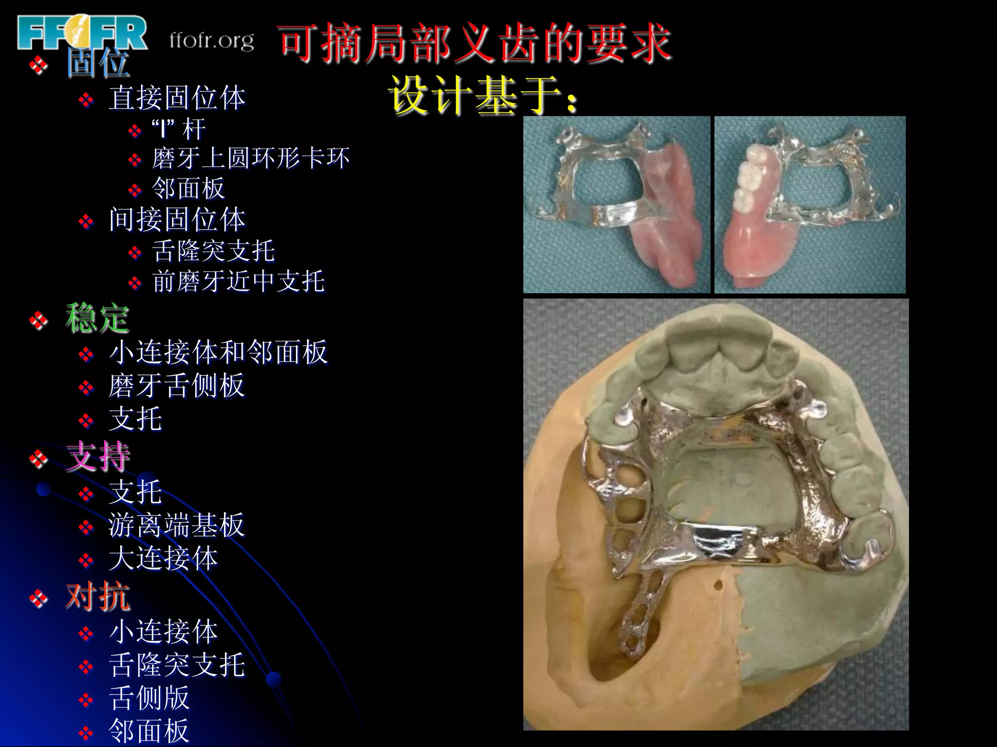 2.rpd biomechanics | PDF