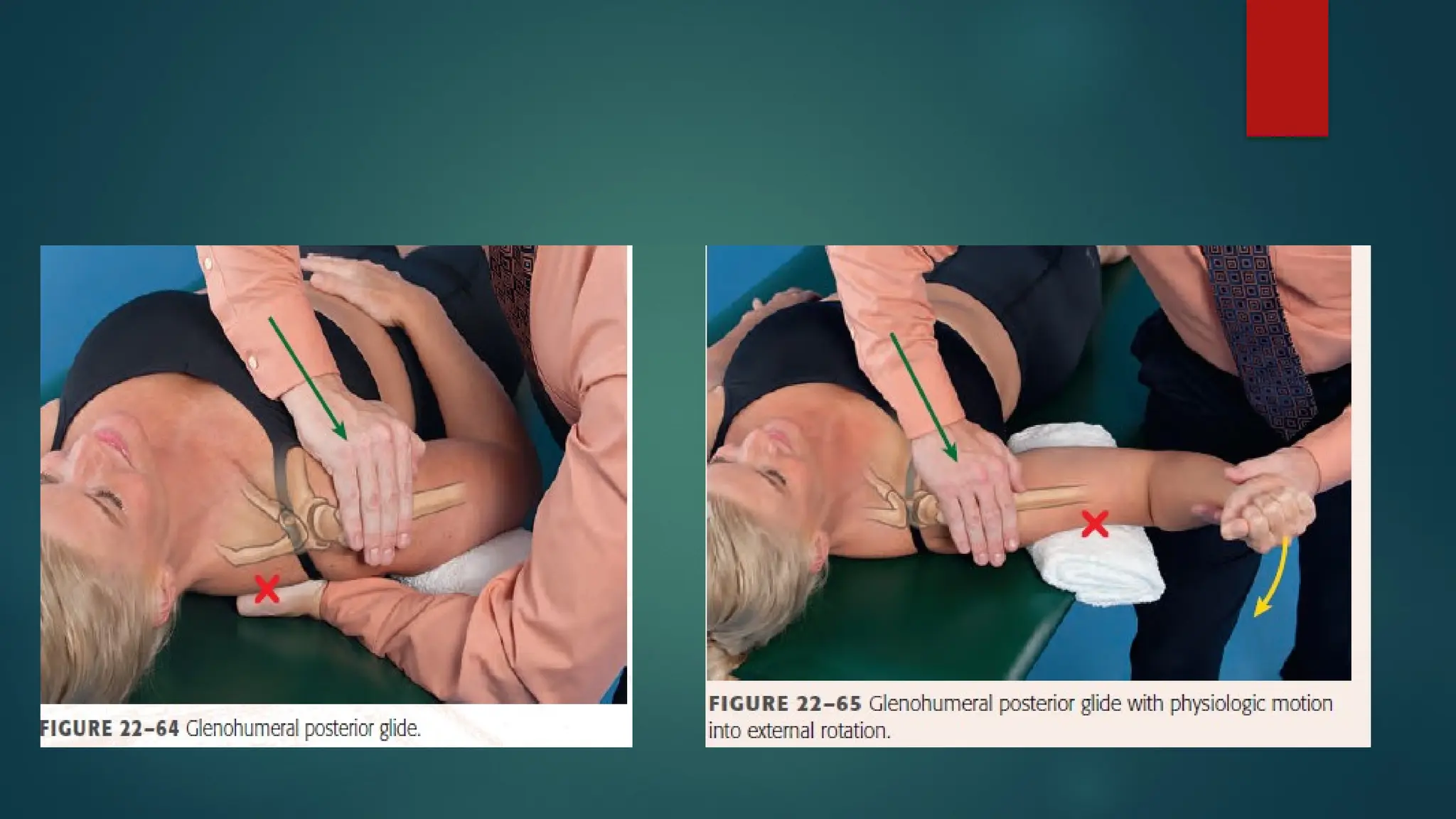 shoulder mobilization.and bone and muscle | PPTX