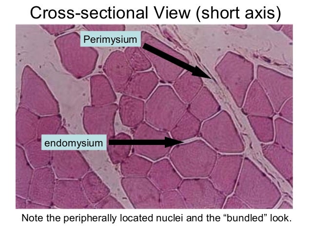 Skeletal Muscle Cross Section