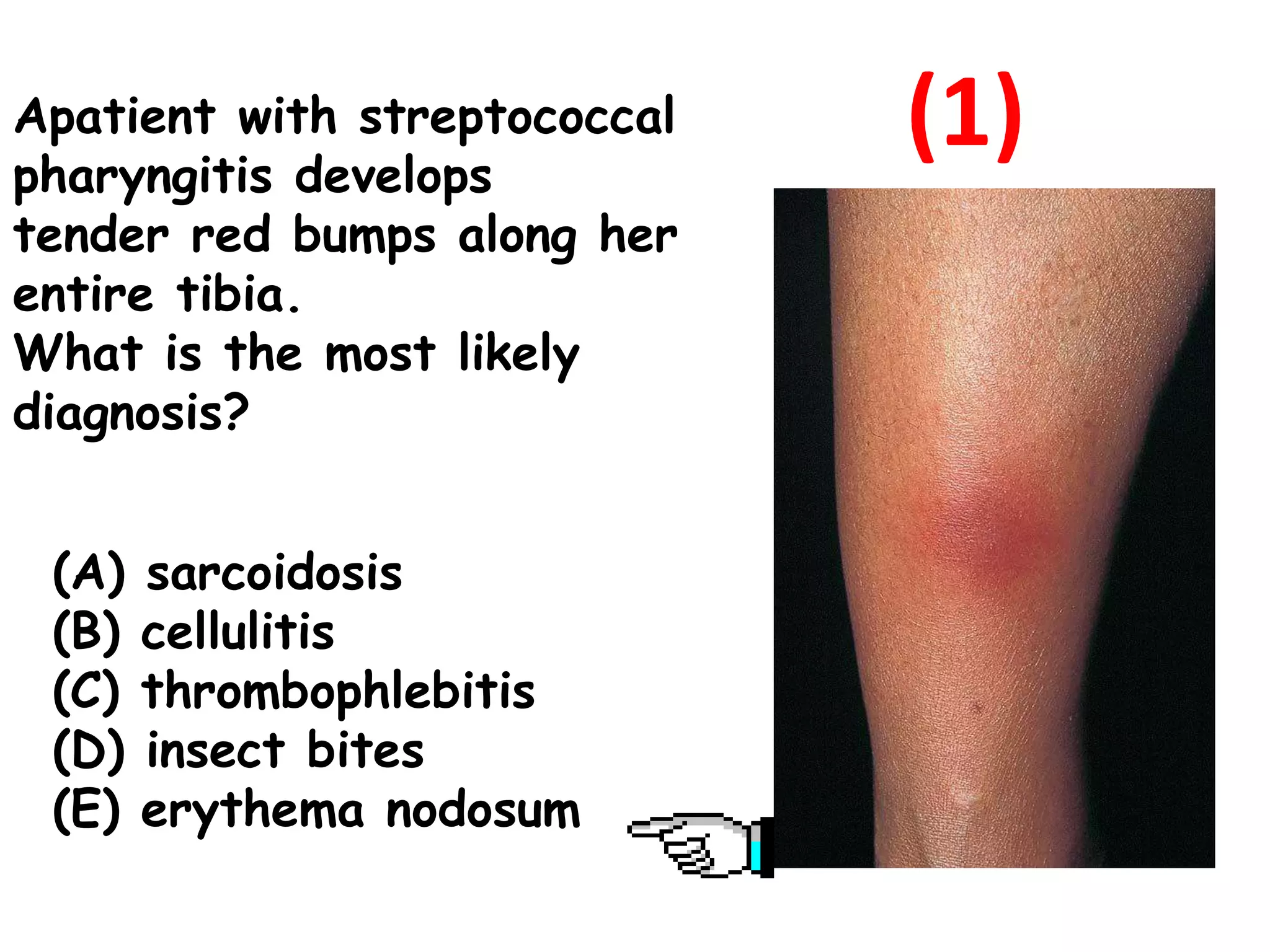 2 spot diagnosis | PPTX