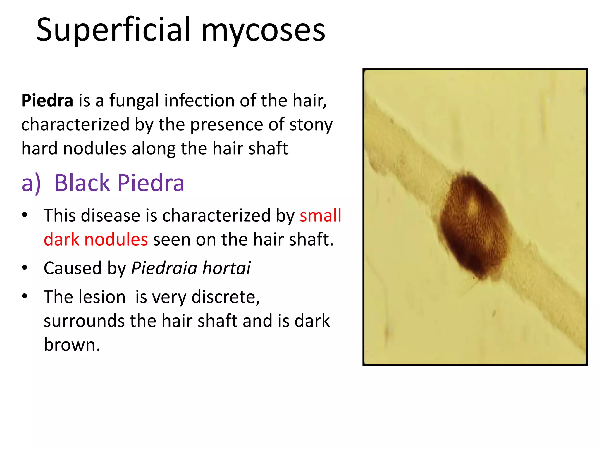2-Superficial, Cutanous &systemic.ppt | Skin and Dermatology | Diseases ...
