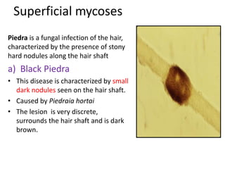 2-Superficial, Cutanous &systemic.ppt | Skin and Dermatology | Diseases ...
