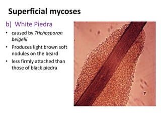 2-Superficial, Cutanous &systemic.ppt | Skin and Dermatology | Diseases ...
