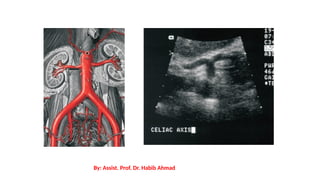 2- Upper Abdominal Vasculature lesson.pptx