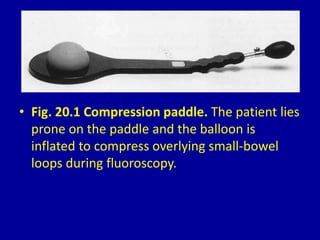 20 DAVID SUTTON PICTURES THE SMALL BOWEL AND PERITONEAL CAVITY | PPT