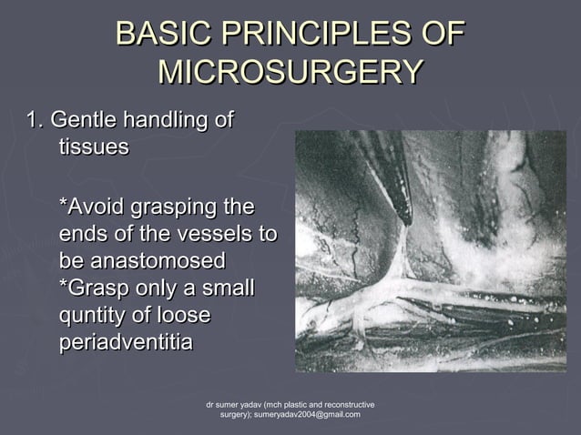 principles of microvascular surgery | PPT | First Aid | Injuries