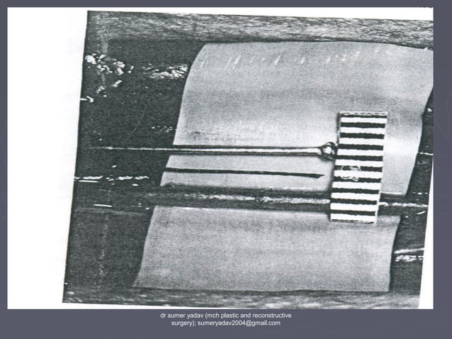 principles of microvascular surgery | PPT | First Aid | Injuries