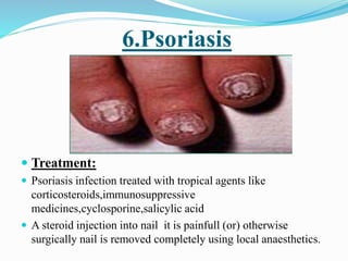 drug delivery through nails | PPTX