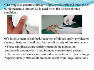drug delivery through nails | PPT