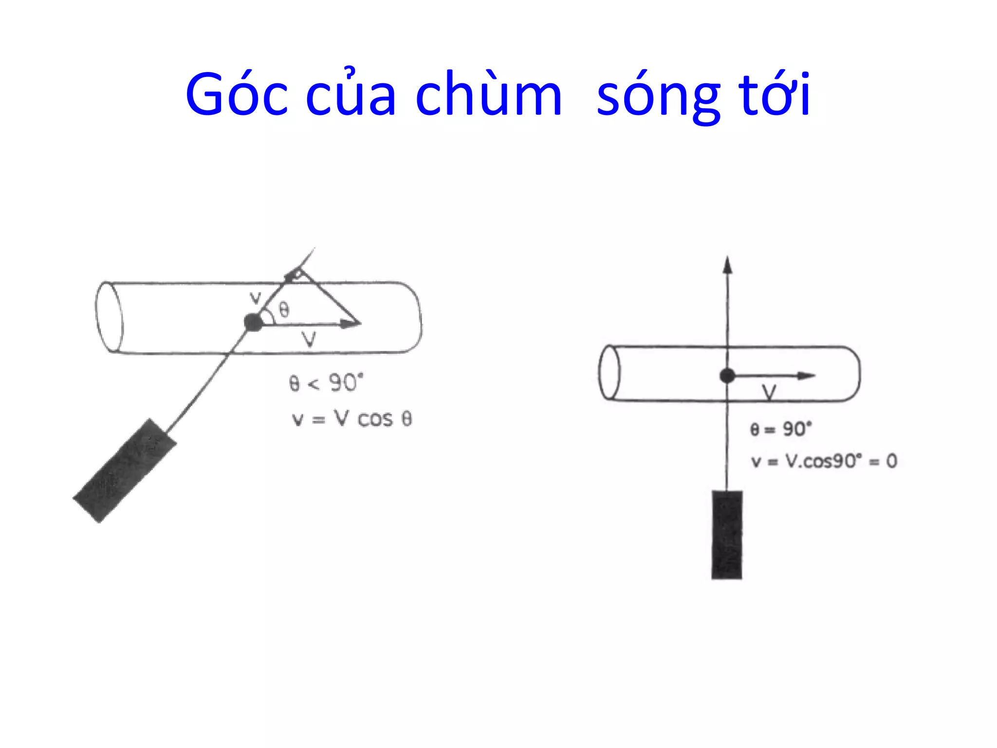 20. Sieu am doppler san khoa, GS Michel Collet | PDF