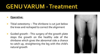 Genu varus and valgus | PPTX