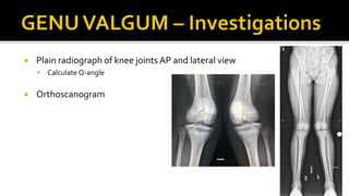 Genu varus and valgus | PPTX