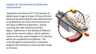 computed tomography | PDF
