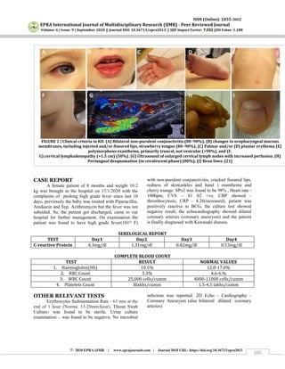 KAWASAKI DISEASE: A CASE REPORT | PDF