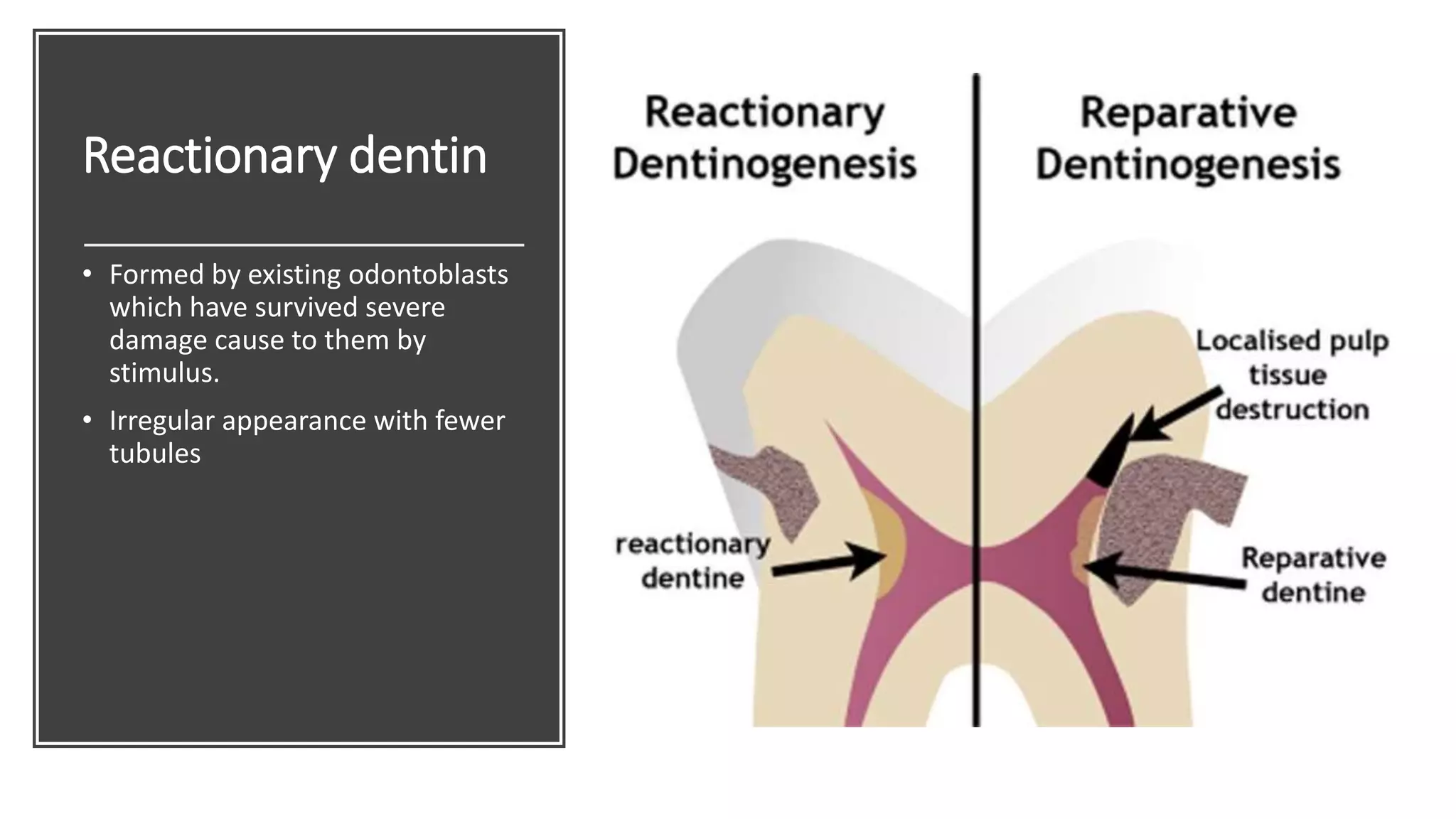 20.dentin.pptx