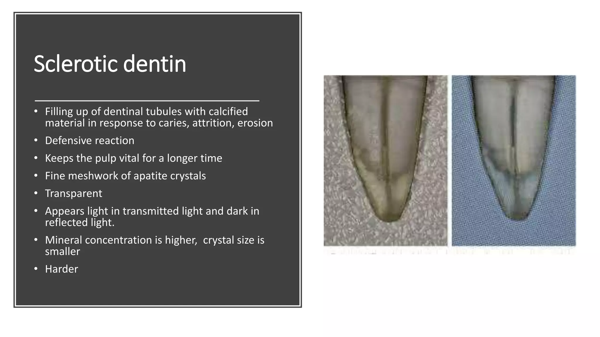 20.dentin.pptx