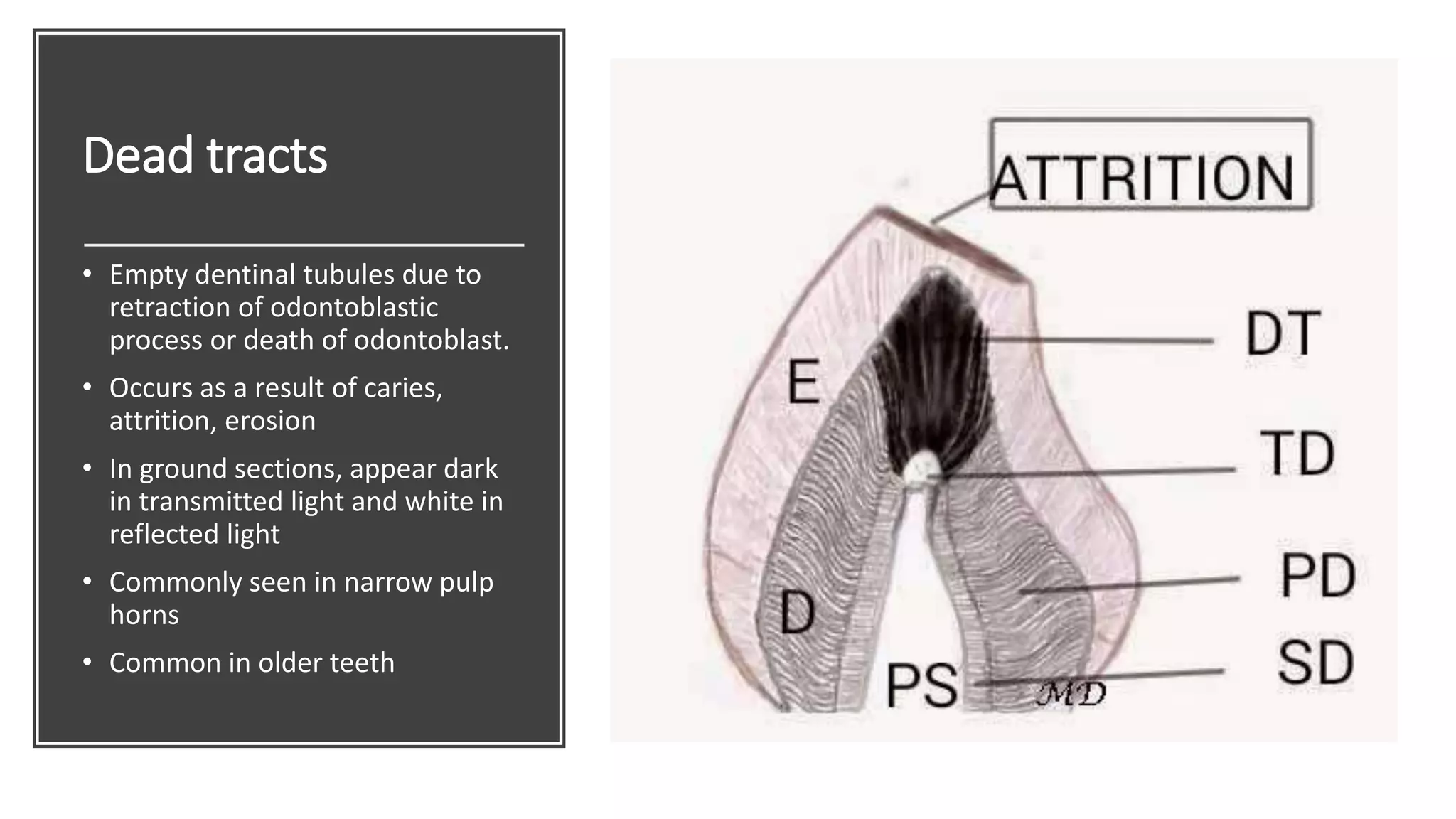 20.dentin.pptx