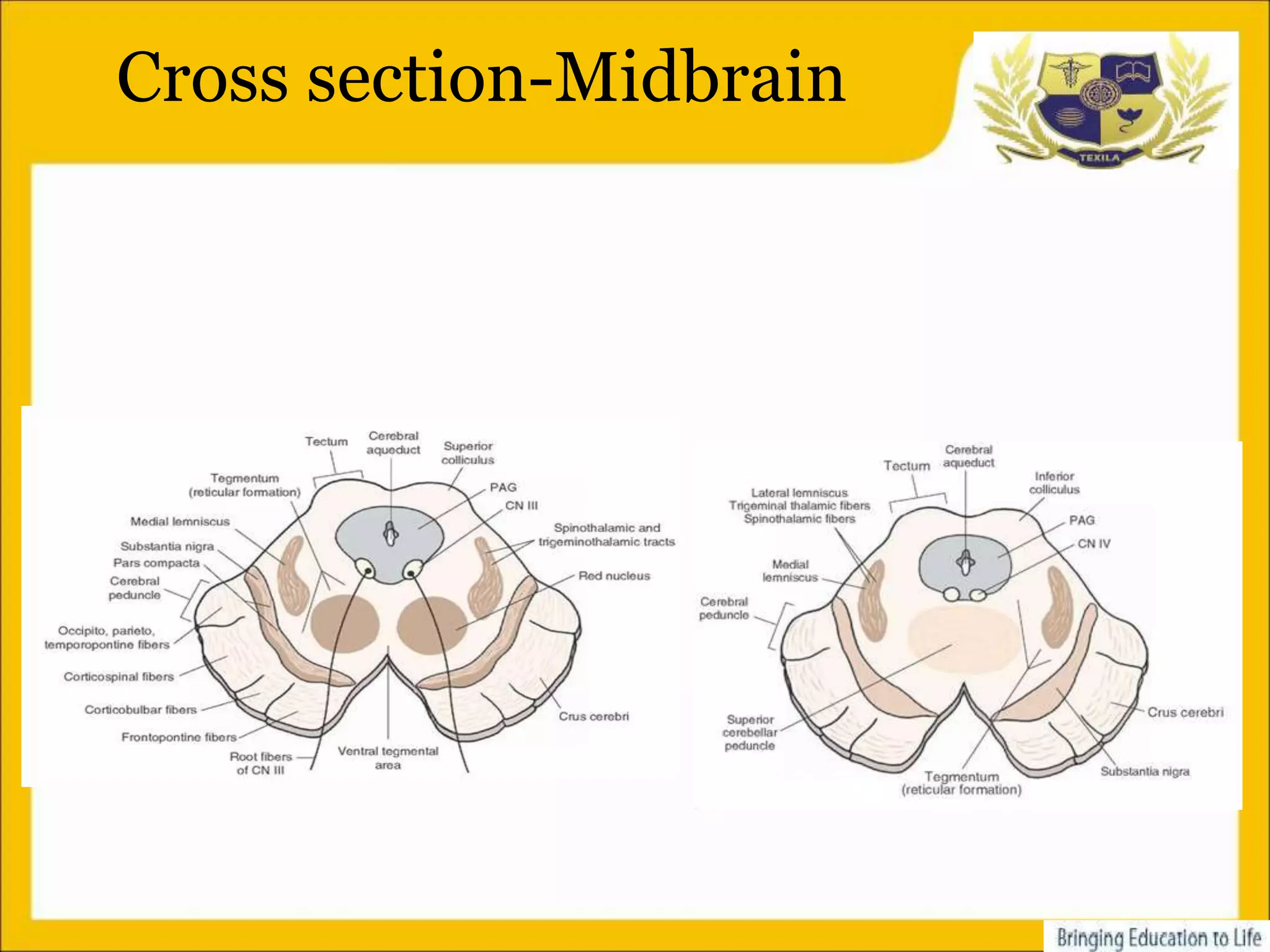 Brain Stem Lesions Anatomy and Physiology | PPTX