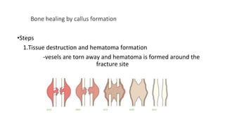 20. Healing and Repair of bone presentation .ppt