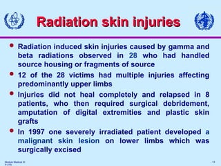 Basics of Radiation Basics of Radiation EAEA | PPT