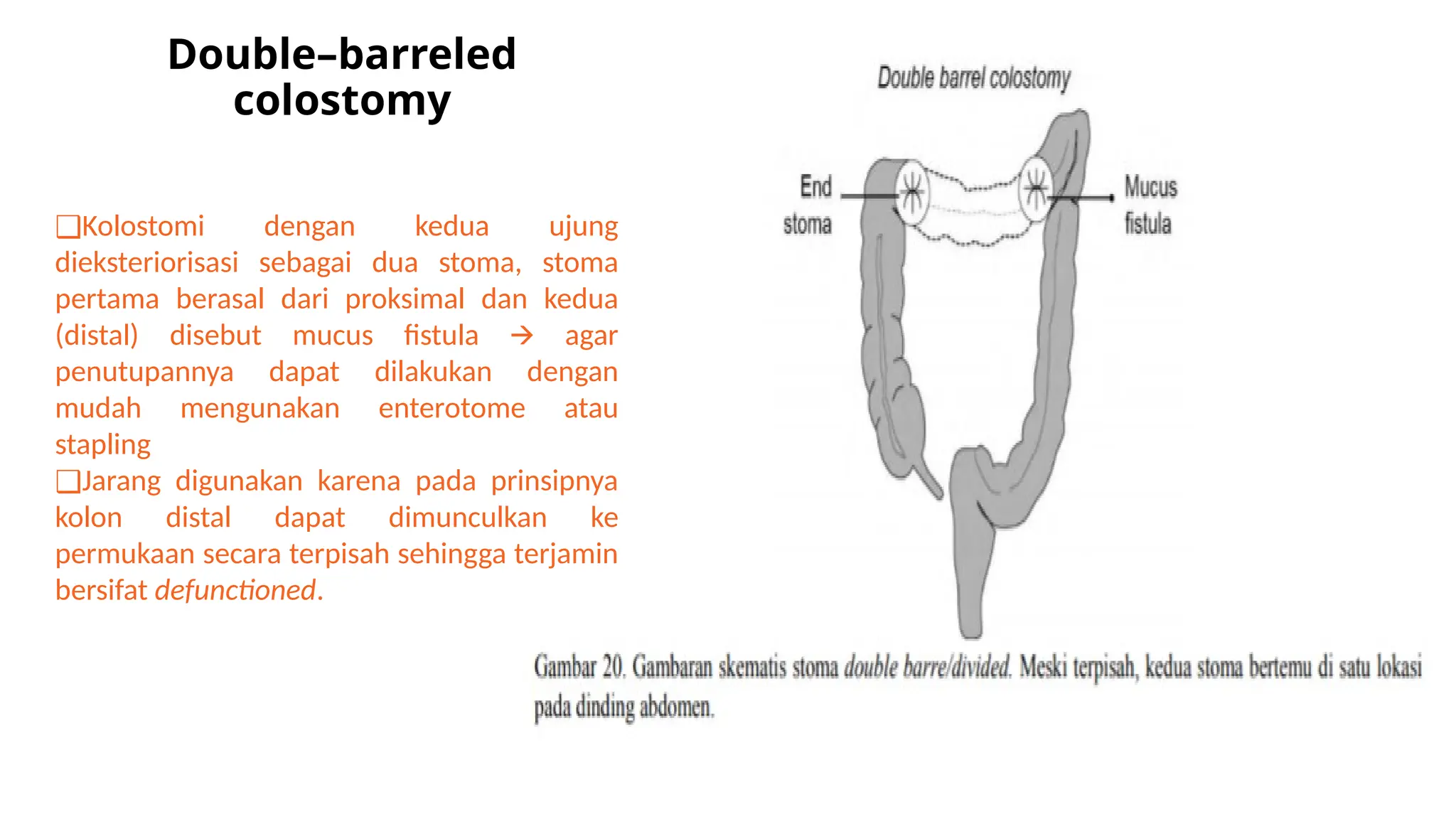 Intestinal stoma powerpoint illeostomy colostomy | PPTX