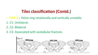 classification of pelvic fracture | PPTX
