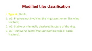 classification of pelvic fracture | PPTX