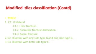 classification of pelvic fracture | PPTX