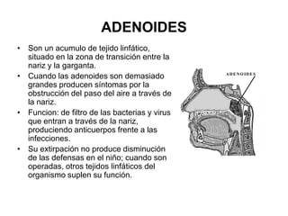 20. adenoiditis | PPTX