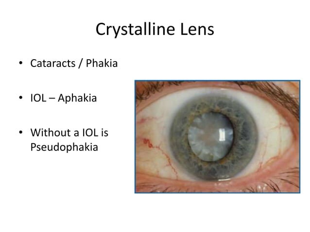 20-eye-diseases.ppt diseae\ses of the eye | PPT